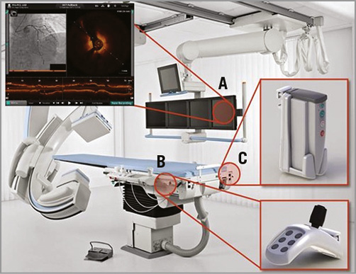 The OPTIS Integrated System: real-time, co-registration of angiography ...