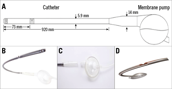 Pulsatile iVAC 2L circulatory support in high-risk percutaneous ...