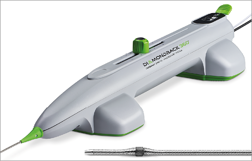 Orbital atherectomy treatment of severely calcified coronary lesions in ...