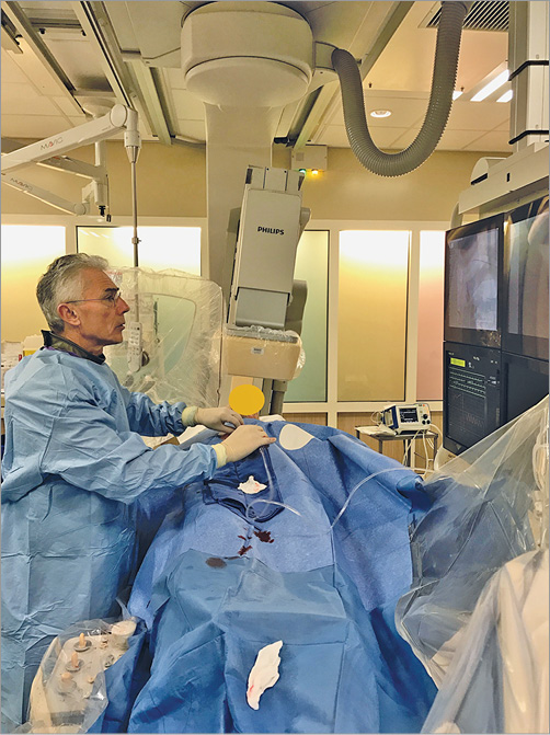 Left distal transradial access in the anatomical snuffbox for coronary ...