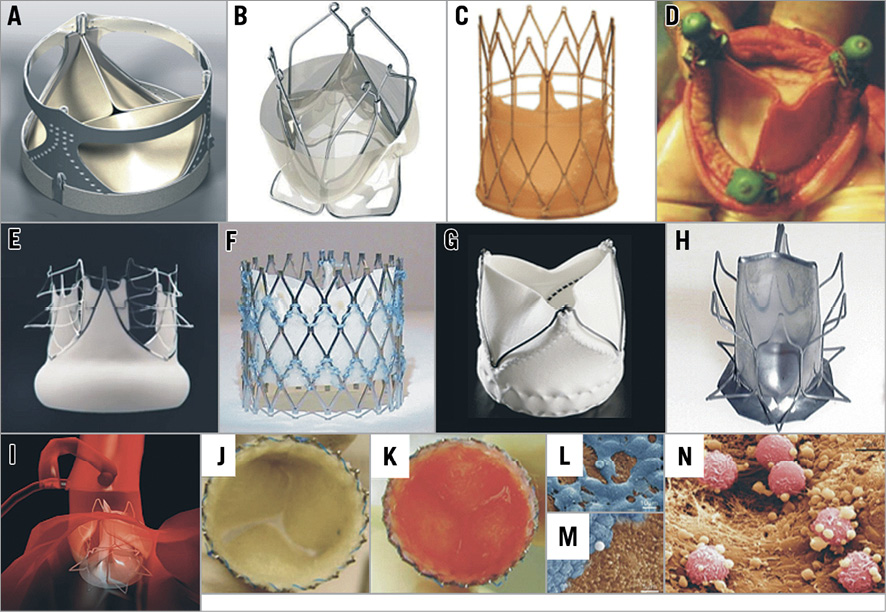 The evolution of device technology in transcatheter aortic valve ...
