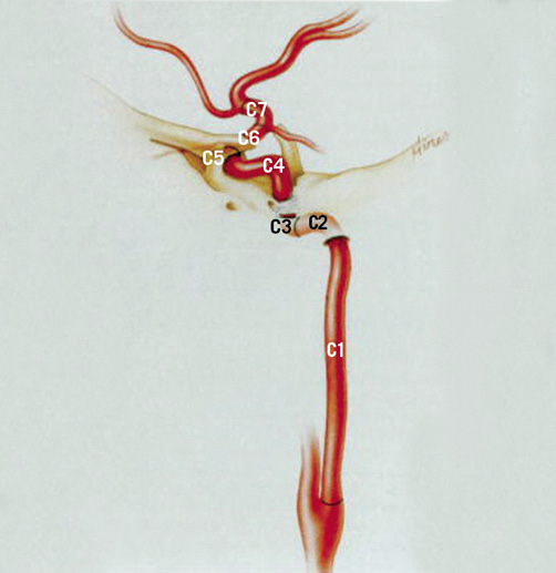 Proposed practical anatomical-procedural classification systems for ...