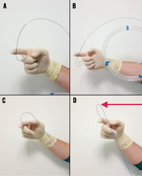 First-in-man assessment of a dedicated guidewire for transcatheter ...