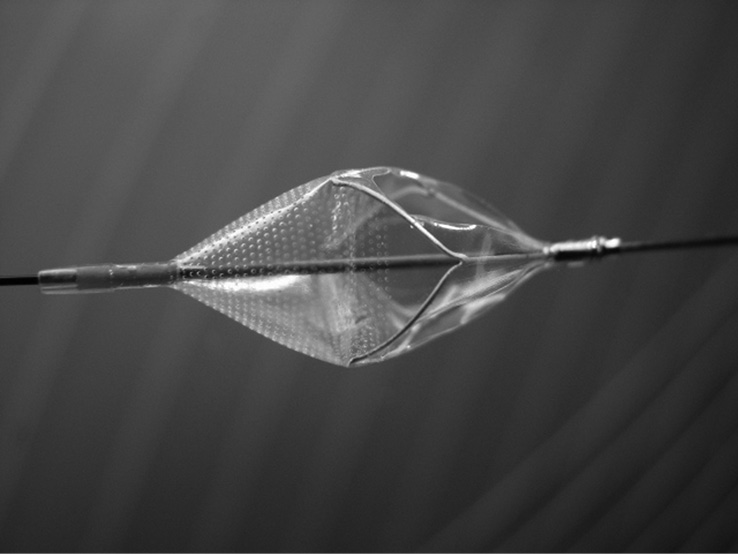 First clinical experience with the GARDEX EPD: a novel embolic ...