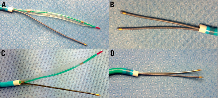 Tools And Techniques Clinical Catheter Compatibility In Cto