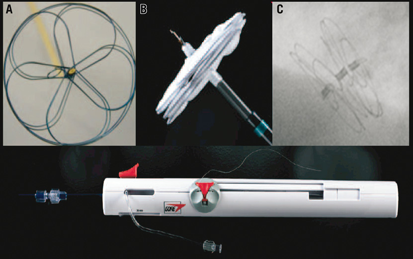 Initial clinical experience with the GORE septal occluder for the ...
