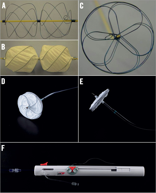 The first clinical experience with the new GORE® septal occluder (GSO ...