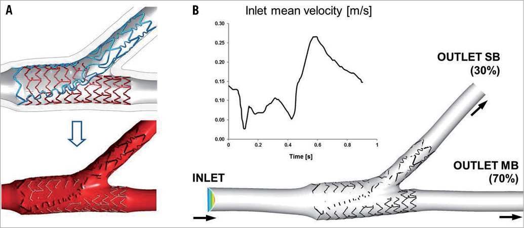 Stent deformation, physical stress, and drug elution obtained with ...