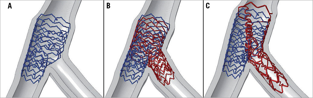 Stent deformation, physical stress, and drug elution obtained with ...
