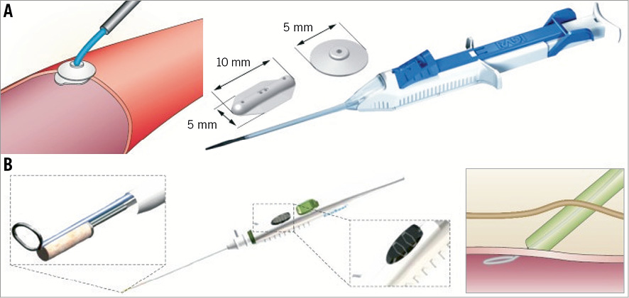 Rationale and design of a randomised clinical trial comparing vascular ...