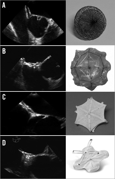 Efficacy of different devices for transcatheter closure of patent ...