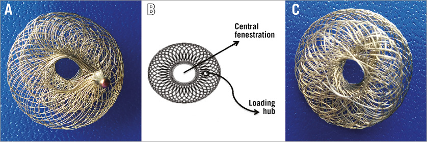 Implantable atrial flow regulator for severe, irreversible pulmonary ...