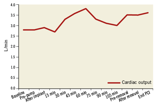 The PulseCath iVAC 2L left ventricular assist device: conversion to a ...