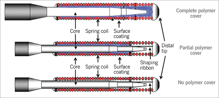 Tools and Techniques – Clinical Update on coronary guidewires 2016 ...