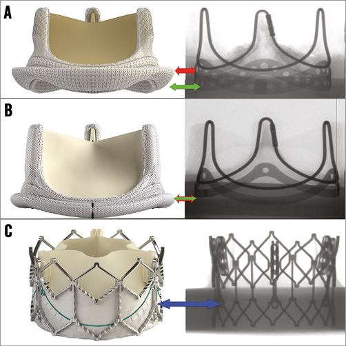 In vitro evaluation of valve-in-valve combinations using a SAPIEN XT ...