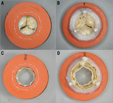 In vitro evaluation of valve-in-valve combinations using a SAPIEN XT ...