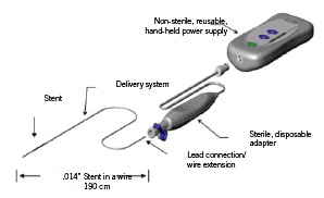 The CardioMind coronary stent delivery system: stent delivery on a .014 ...