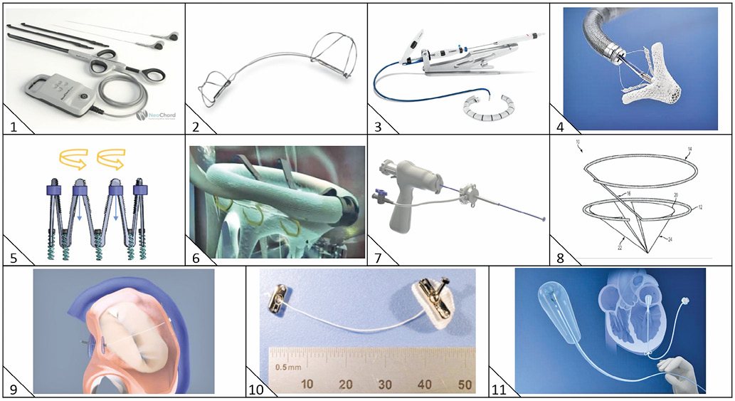 The big parade: emerging percutaneous mitral and tricuspid valve ...