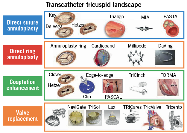 Tricuspid regurgitation: what is the real clinical impact and how often ...