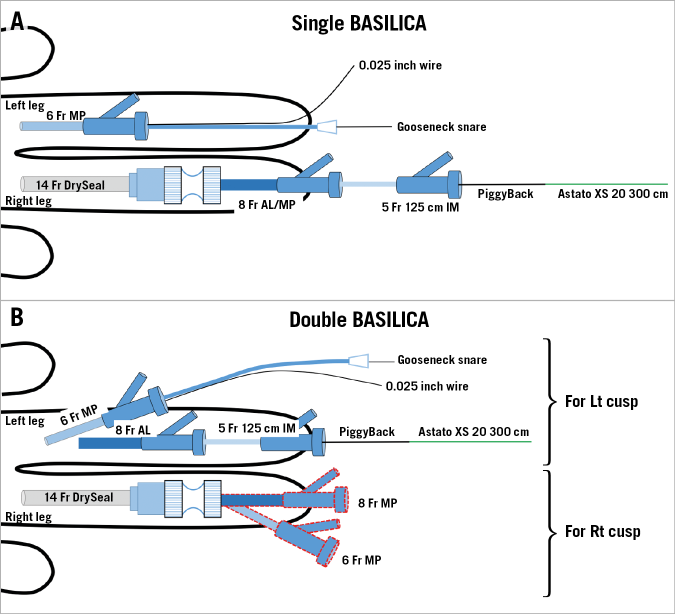 Bioprosthetic or native aortic scallop intentional laceration to ...