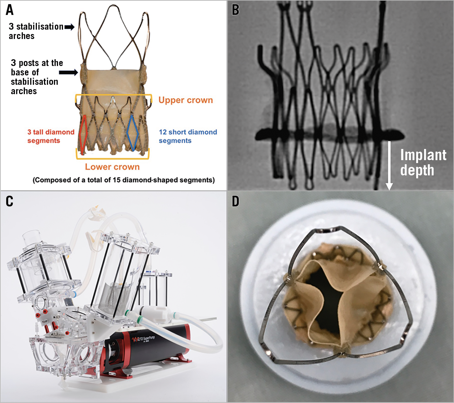 Impact of implant depth on hydrodynamic function with the ACURATE neo ...