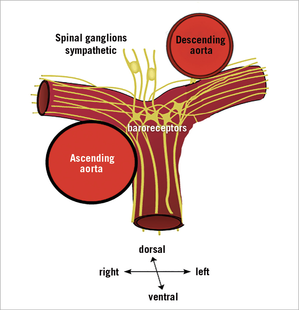 Pulmonary artery denervation – the time has come for a multicentre ...