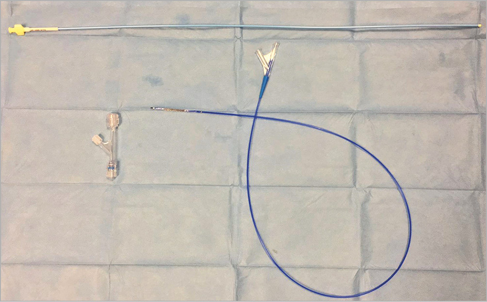 Technical aspects in coronary sinus Reducer implantation - EuroIntervention