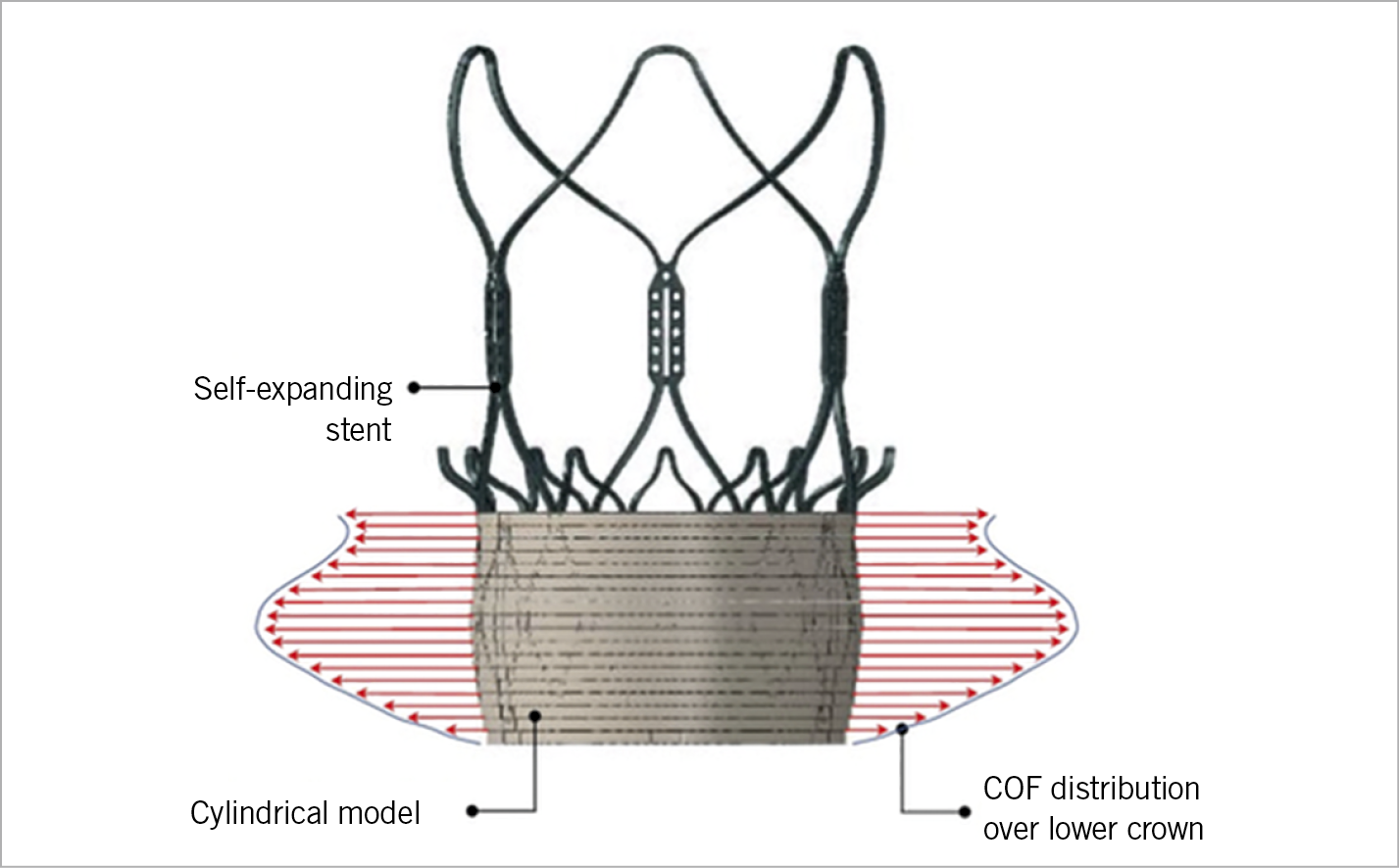 Transcatheter aortic valve implantation with the ACURATE neo valve ...