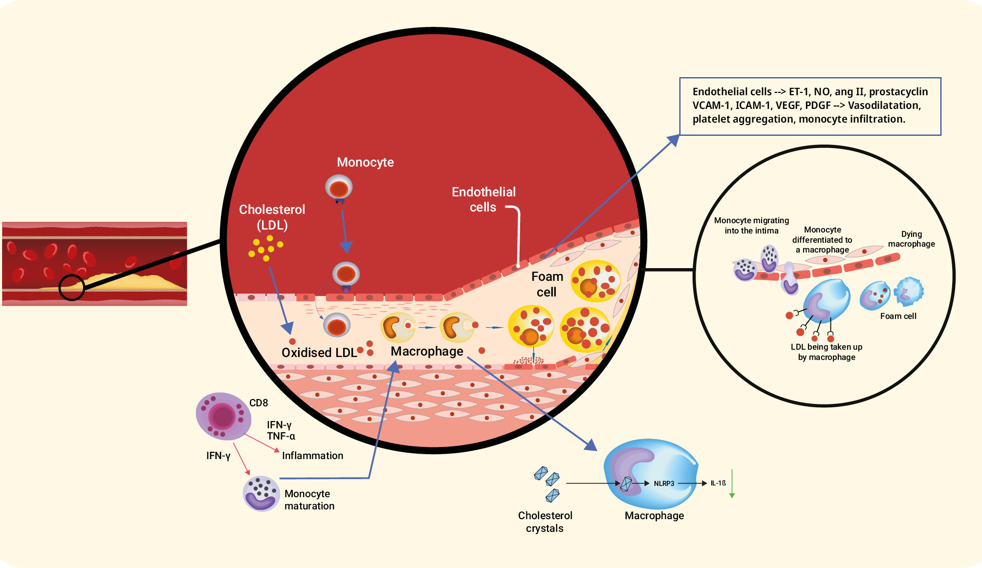 Targeting inflammation in atherosclerosis: overview, strategy and ...