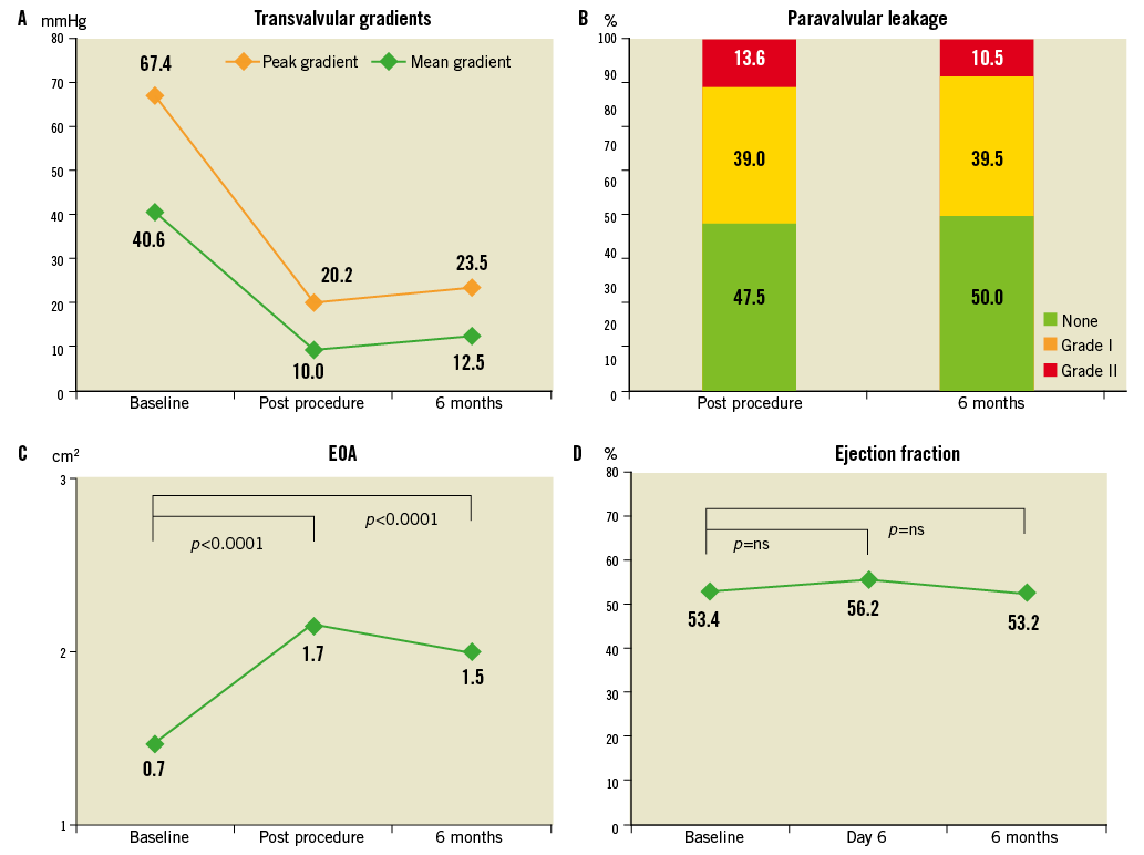 JenaValve - EuroIntervention