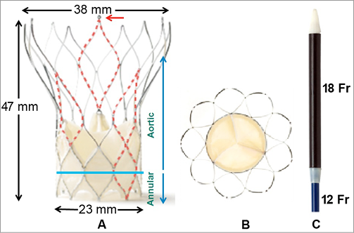 St Jude Medical Portico valve - EuroIntervention