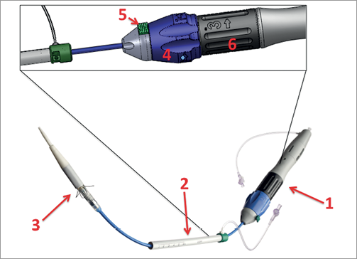 Medtronic Engager™ bioprosthesis for transapical transcatheter aortic ...