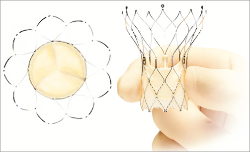 New-generation TAVI devices: description and specifications ...