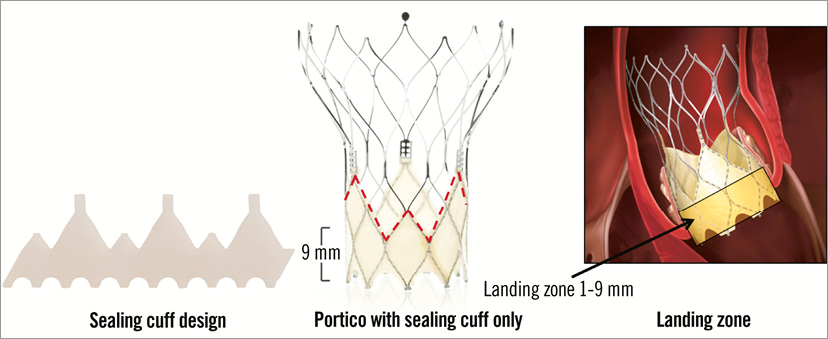 New-generation TAVI devices: description and specifications ...