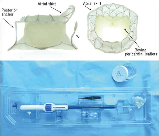 Transcatheter mitral valve implantation: Tiara - EuroIntervention