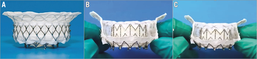 Intrepid transcatheter mitral valve replacement system: technical and ...